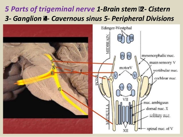 Presentation1, radiological imaging of trigeminal schwanoma.