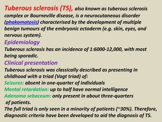 Tuberous Sclerosis Eye