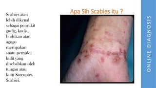 Presentation1 scabies .pptx