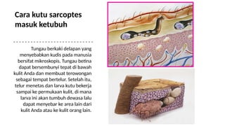 Presentation1 scabies .pptx