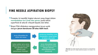 Presentation1 sialolithiasis presentation | PPT