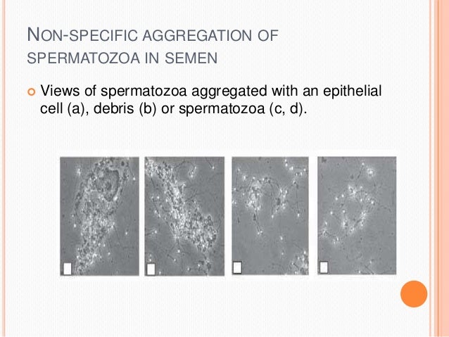 semen analysis-in fertility management