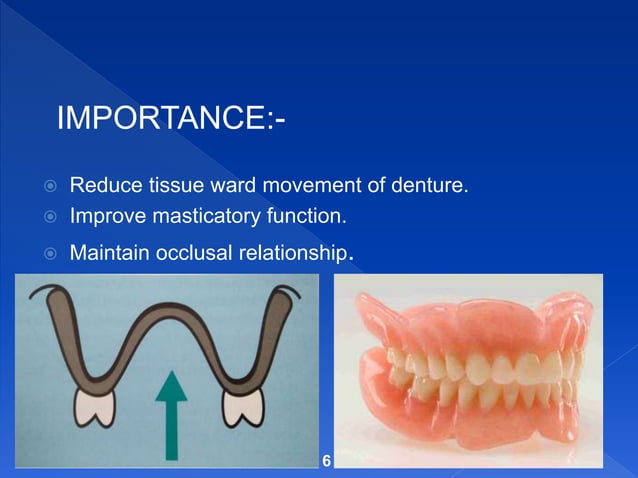 Presentation1 support for complete denture | PPTX | Dental Health ...