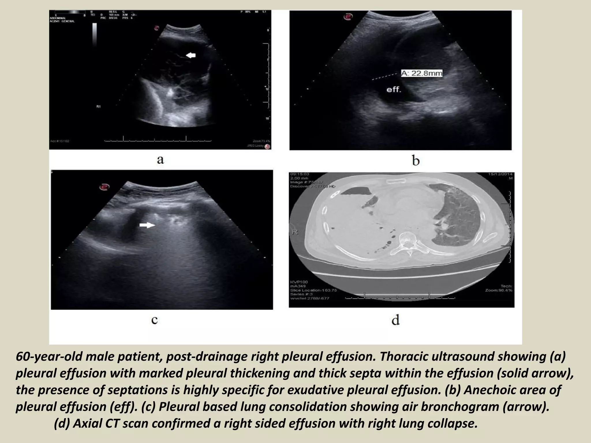 Presentation1, ultrasound examination of the chest. | PPTX