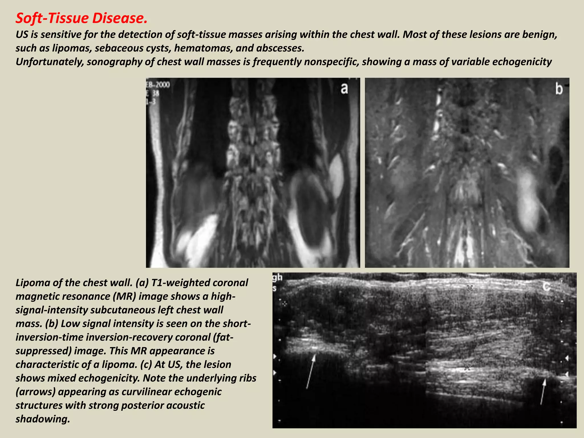 Presentation1, ultrasound examination of the chest. | PPTX