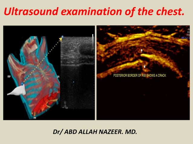Presentation1, ultrasound examination of the chest. | PPTX | Lung and ...
