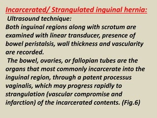 Presentation1, Ultrasound of the bowel loops and the lymph nodes..pptx