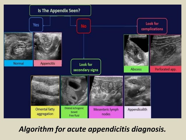 Presentation1, Ultrasound of the bowel loops and the lymph nodes..pptx