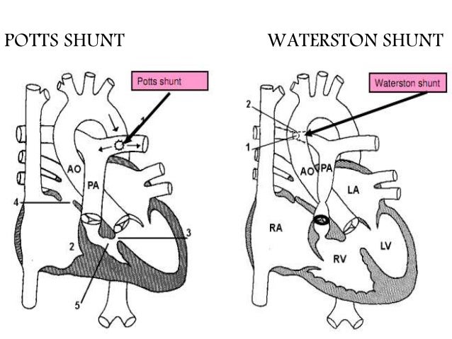 Presentation1 virbhan, TOF Dr Virbhan Balai