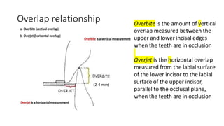 Occlusion and Mmf vv-1.pptx