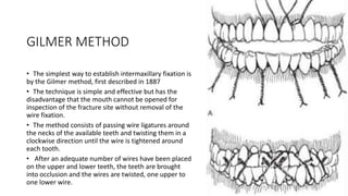 Occlusion and Mmf vv-1.pptx