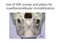 Occlusion and Mmf vv-1.pptx