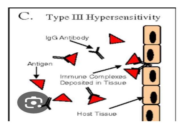 Presentation about Hypersensitivities.pptx