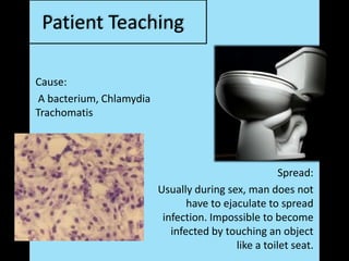 Chlamydia Class Presentation | PPTX