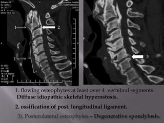 RADIOLOGY PRESENTATION | PPTX | Digestive Disorders | Diseases and ...
