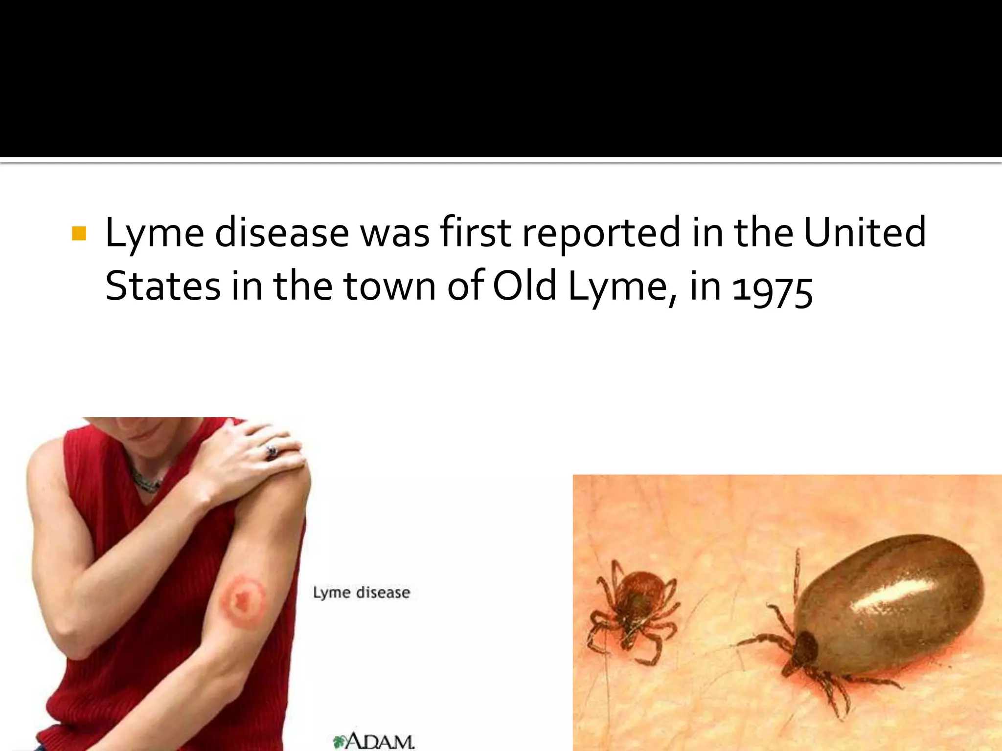 Lyme disease | PPT
