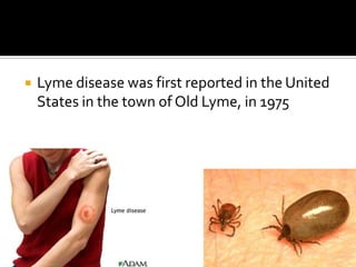 Lyme disease | PPTX