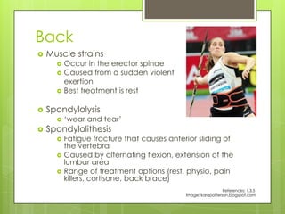 Common Injuries in Javelin | PPTX