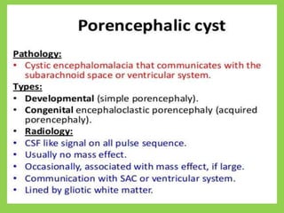 Porencephalic Cyst Pathology