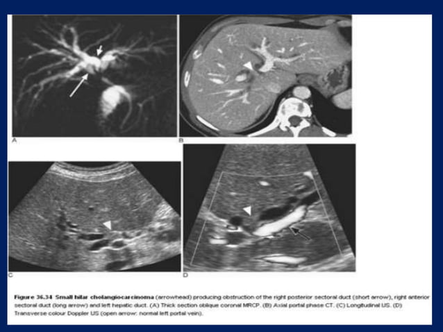 Presentation2.pptx imaging of the biliary system | PPT