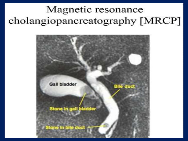 Presentation2.pptx imaging of the biliary system | PPTX