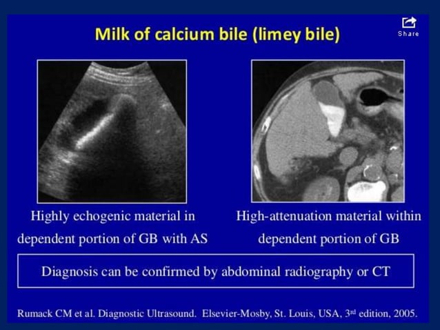 Presentation2.pptx imaging of the biliary system | PPT
