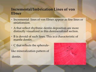 Incremental Lines Of Von Ebner