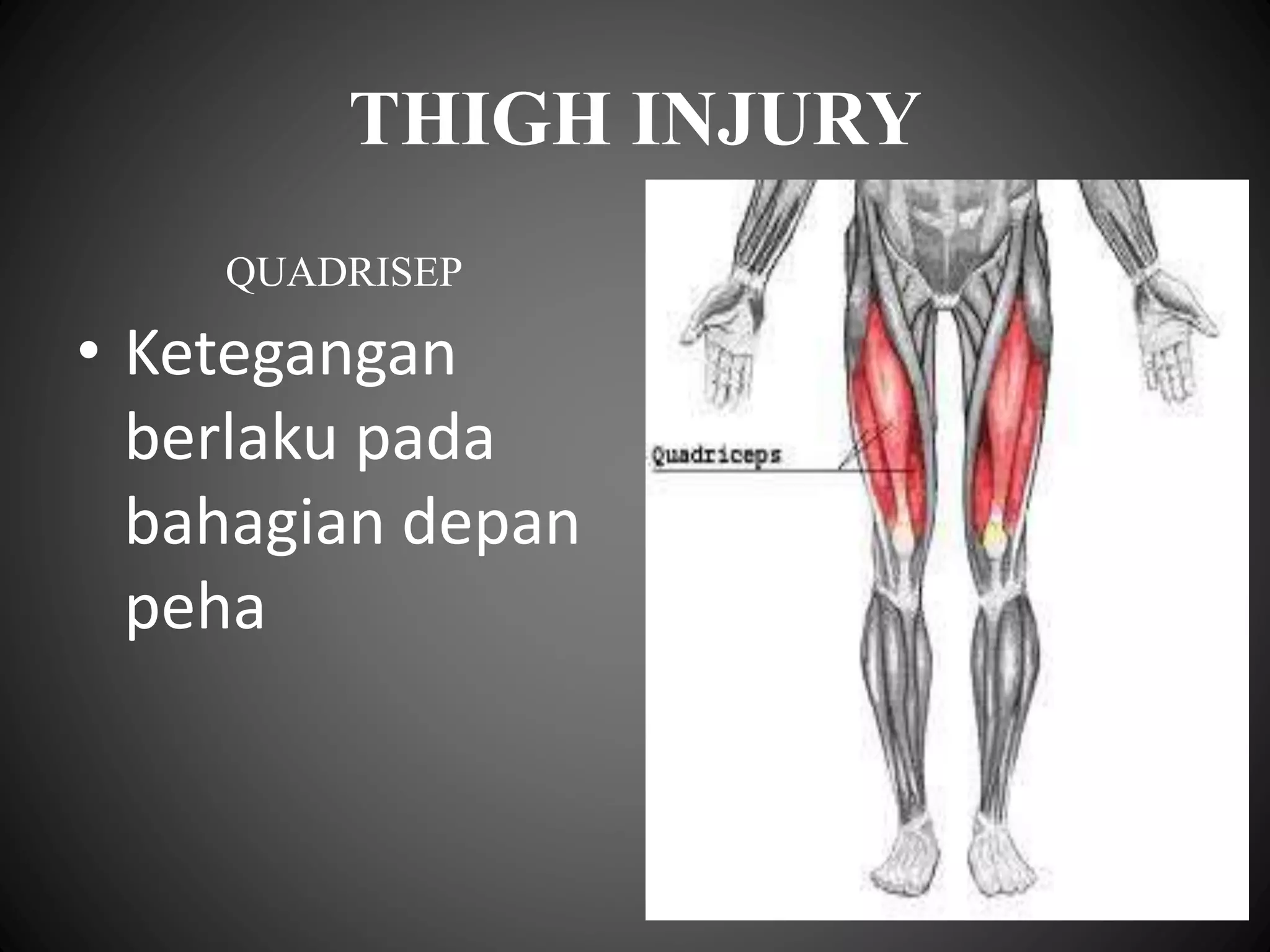 KNEE AND THIGH INJURIES | PPTX