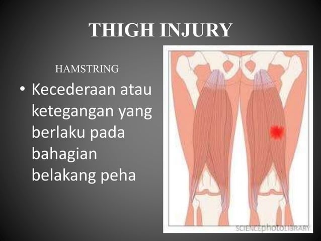 KNEE AND THIGH INJURIES | PPT