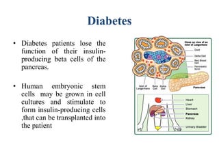 Stem cell therapy | PPTX
