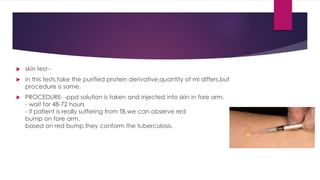 tuberculosis ppt by laxmi prasanna vemireddy | PPTX