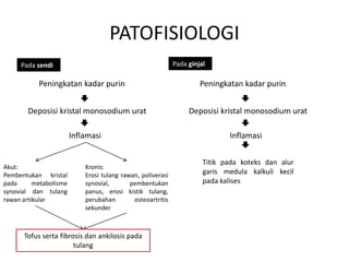 Artritis Gout | PPTX