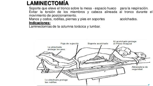 Posiciones Quirurgicas e indicaciones