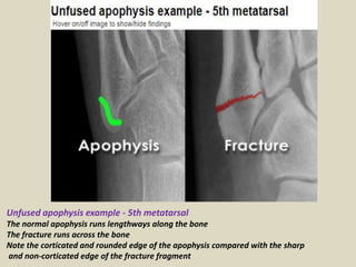 Presentation2. radiological film reading for fractures. | PPT