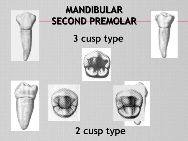 Permanent Mandibular First Premolar and Differences between First and Second Premolar | PPT