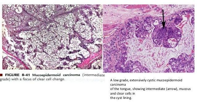 Intermediate Cells