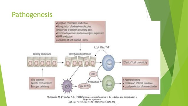 Neurological Involvement in Sjogren’s Syndrome | PPTX