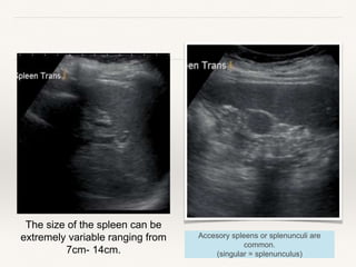 Ultrasound of pancreas and spleen | PPTX