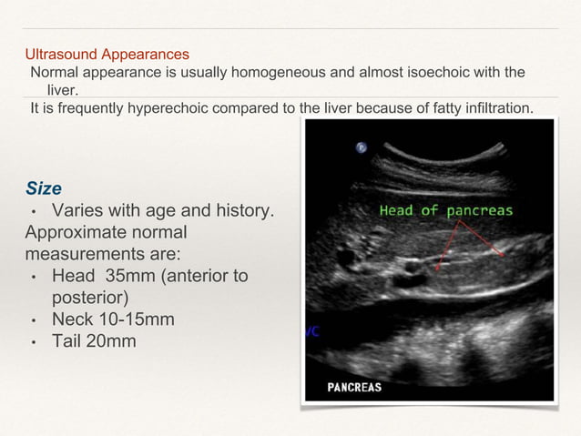 Ultrasound of pancreas and spleen | PPTX | Digestive Disorders ...