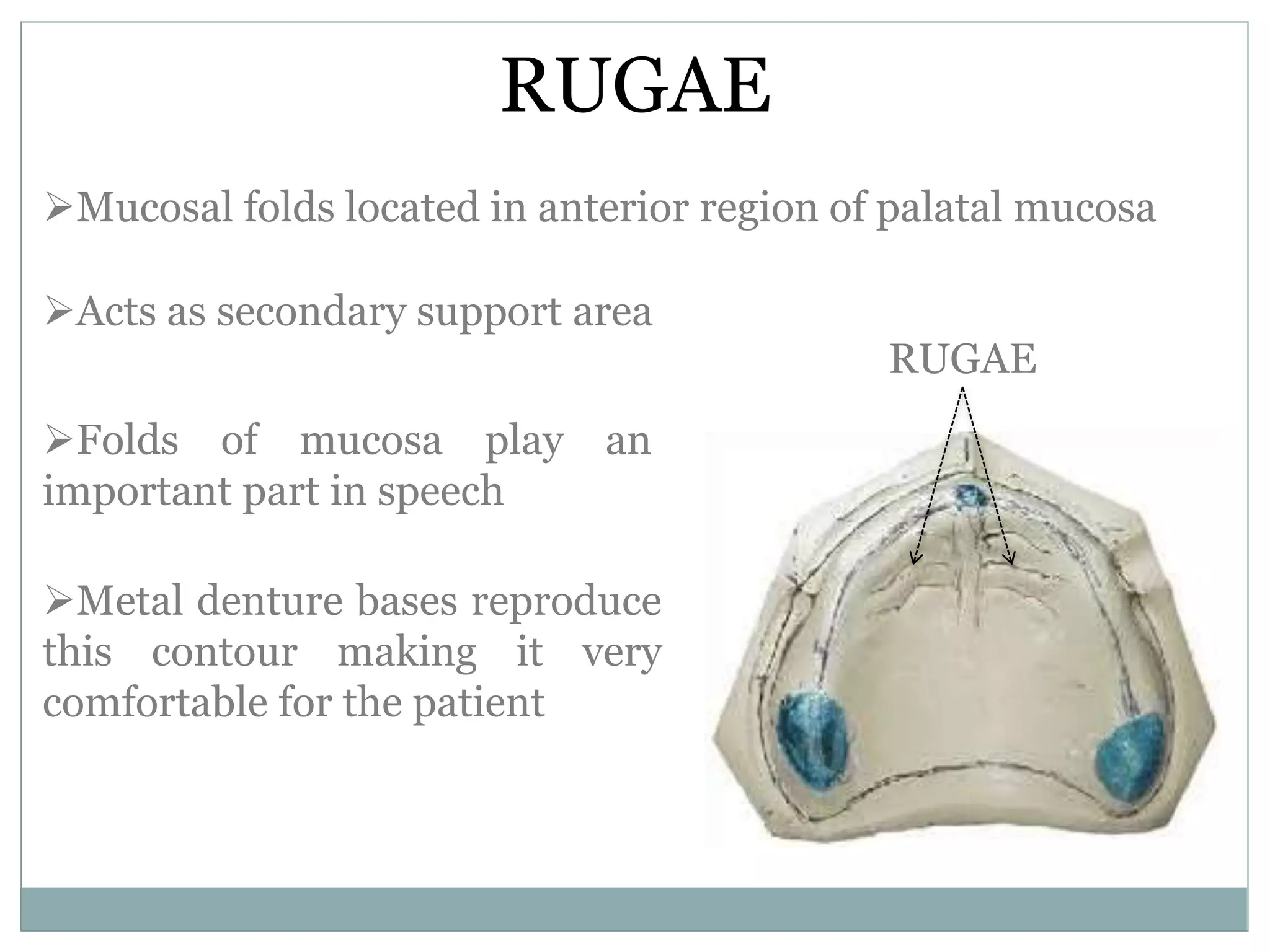 ANATOMICAL LANDMARKS OF MAXILLA | PPTX