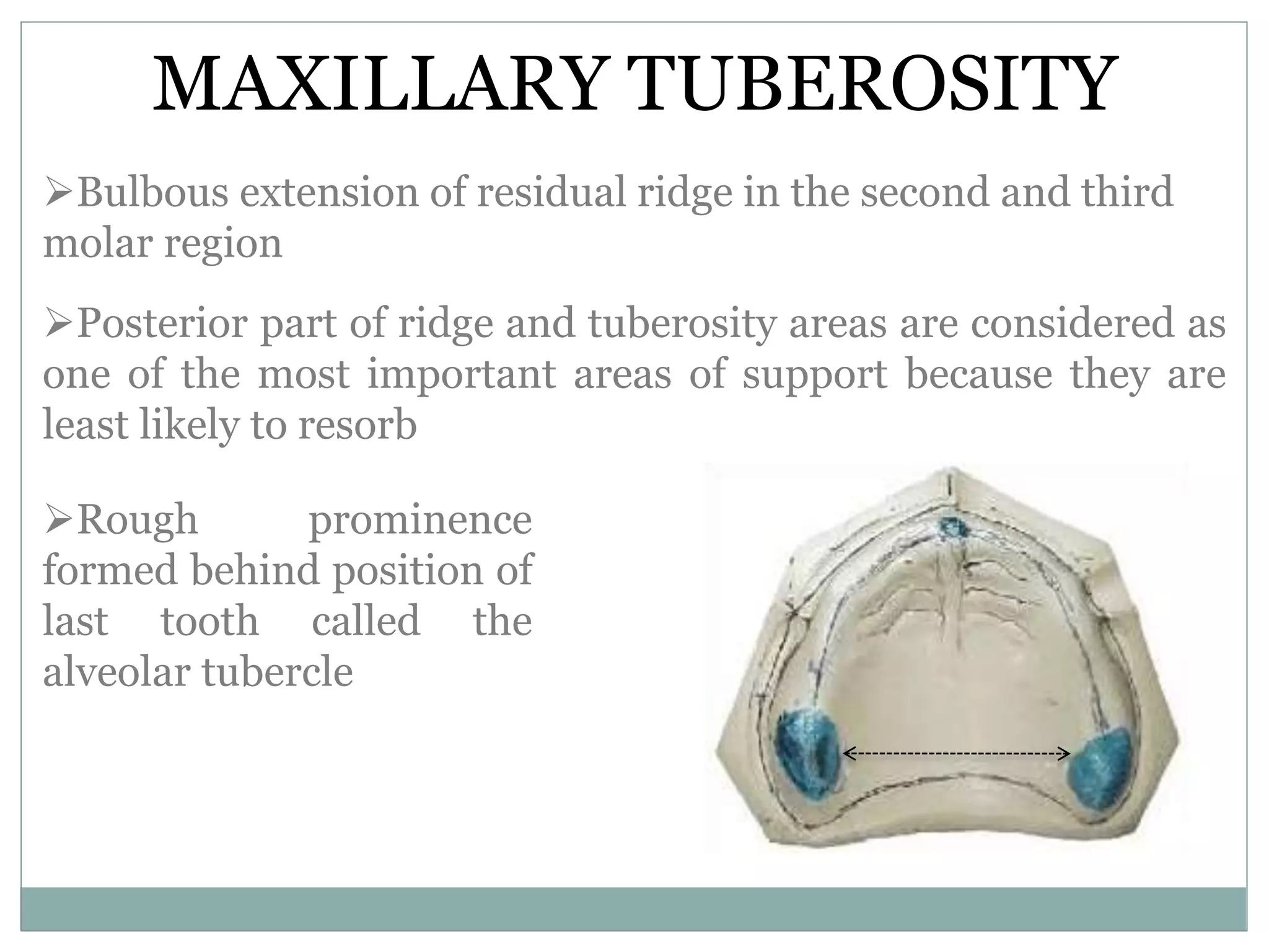 ANATOMICAL LANDMARKS OF MAXILLA | PPTX