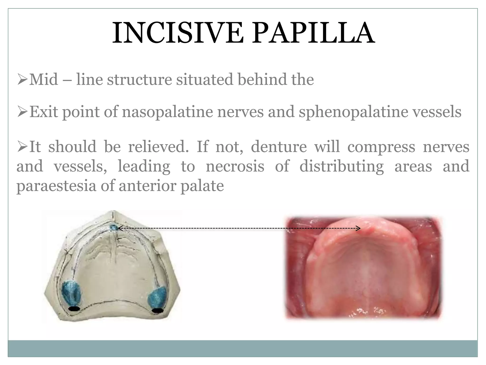 ANATOMICAL LANDMARKS OF MAXILLA | PPTX