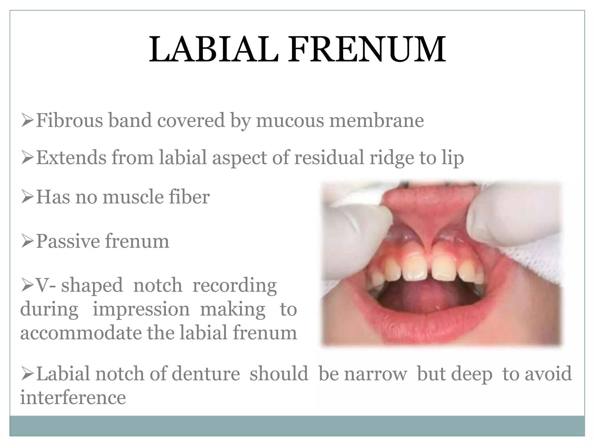 ANATOMICAL LANDMARKS OF MAXILLA | PPTX