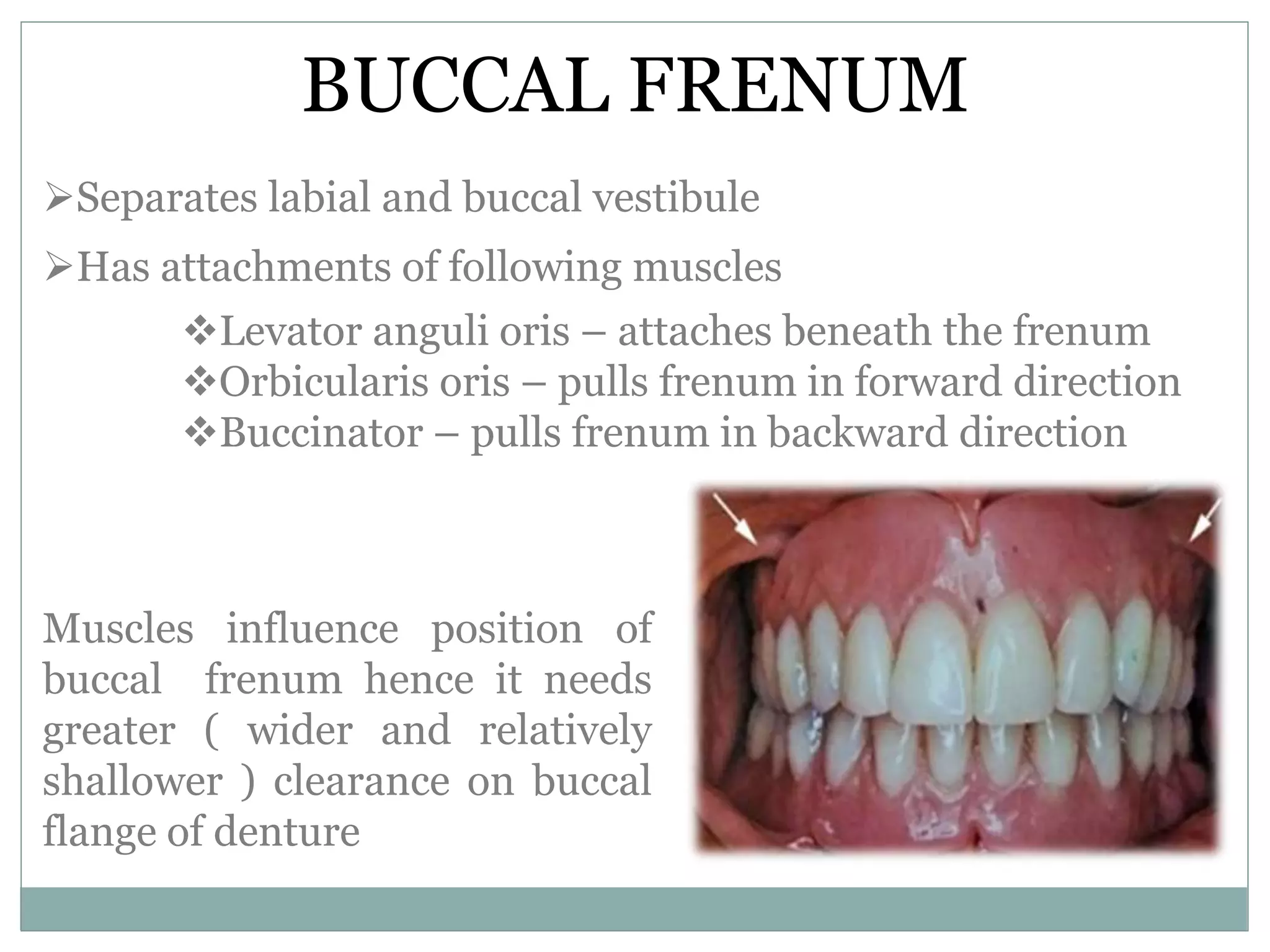 ANATOMICAL LANDMARKS OF MAXILLA | PPTX