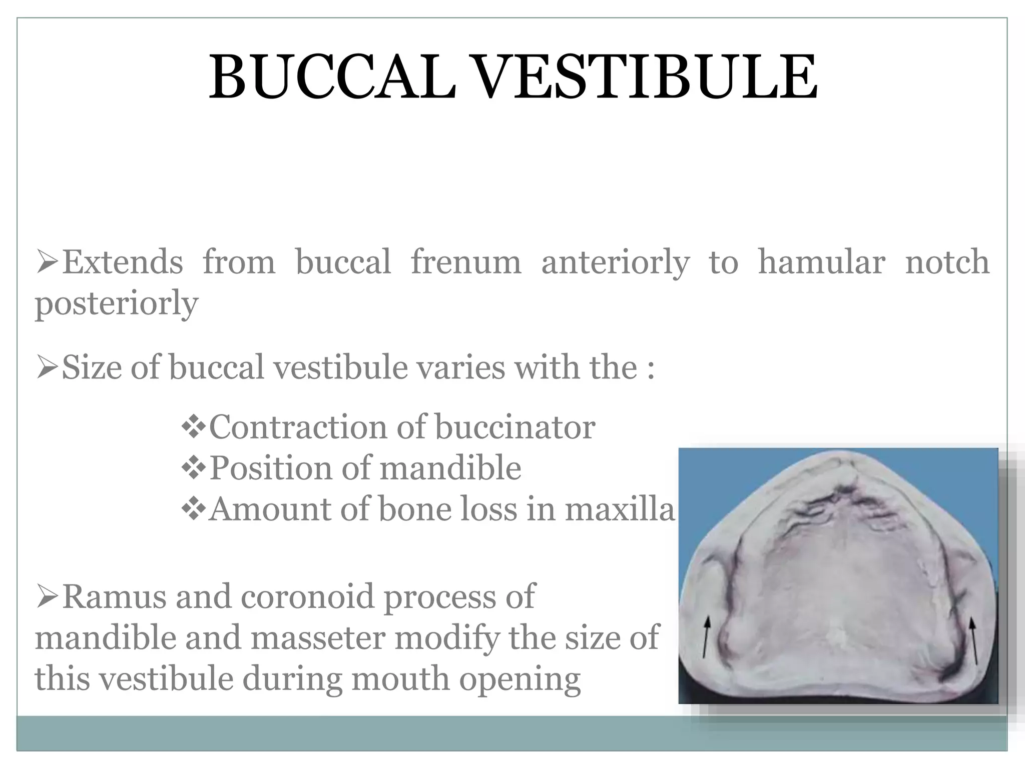 ANATOMICAL LANDMARKS OF MAXILLA | PPTX