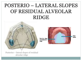 ANATOMICAL LANDMARKS OF MAXILLA | PPTX
