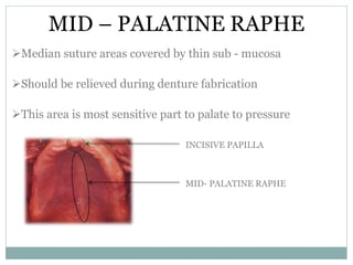 ANATOMICAL LANDMARKS OF MAXILLA | PPTX