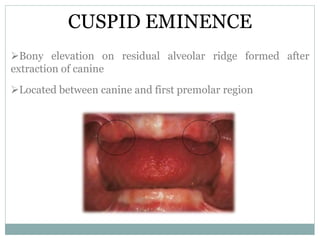 ANATOMICAL LANDMARKS OF MAXILLA | PPTX