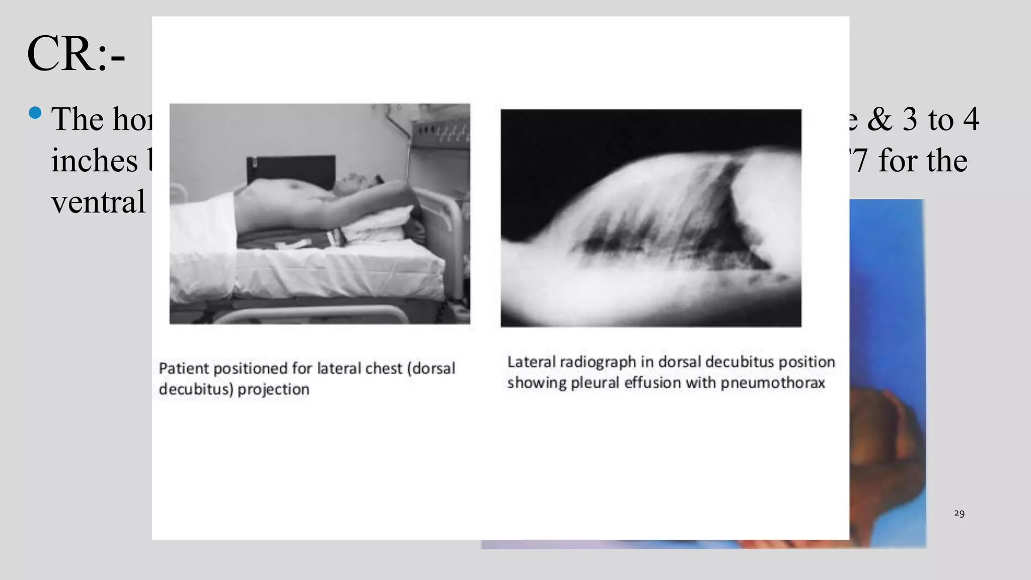 Presentation2.pptx technique chest 2 | PPT