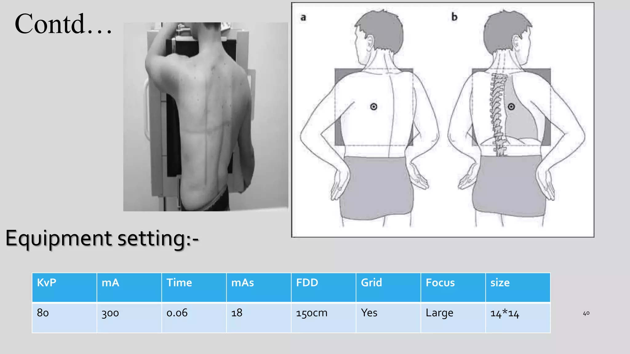 Presentation2.pptx technique chest 2 | PPT